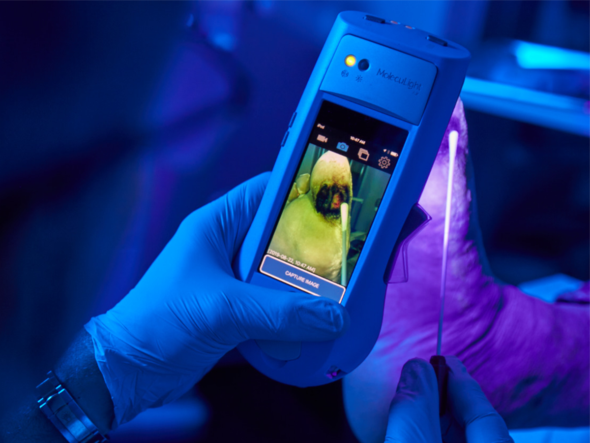 MolecuLight i:X System